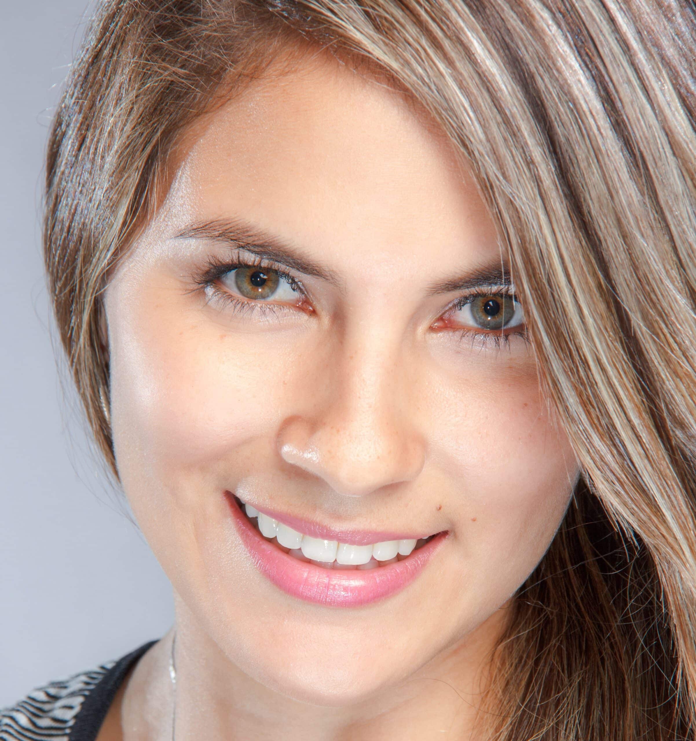 The MTM® Procedure for Minor Orthodontic Issues | Dr. Jack Ringer, CA ...